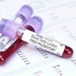 TDL Biochemistry Test | British Clinic